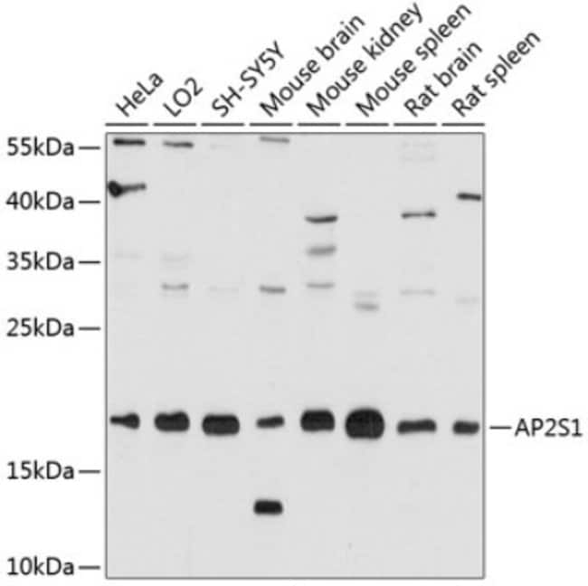 AP2S1 Rabbit anti-Human, Mouse, Rat, Polyclonal, Novus Biologicals 20 μg; | Fisher Scientific